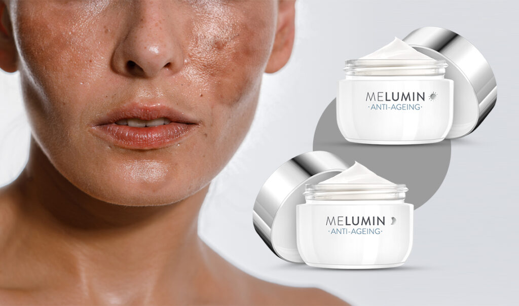 „De ce am pete maronii pe piele?” Ce trebuie să știi despre apariția ...